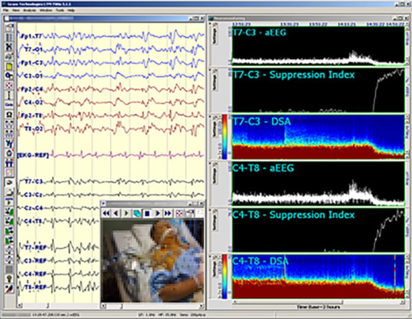 MN Epilepsy Group | Focused expertise. Comprehensive care.