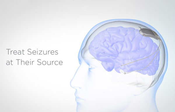 MN Epilepsy Group | Focused expertise. Comprehensive care.