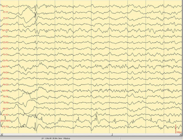 MN Epilepsy Group | Focused expertise. Comprehensive care.
